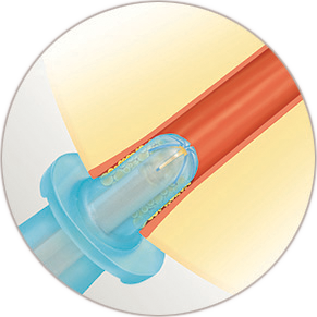 VaPro No Touch Intermittent Catheters | Hollister US